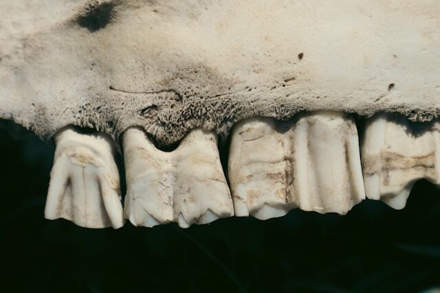 The Causes of Black Teeth